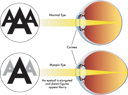 Treatment – My Macular Degeneration Journal